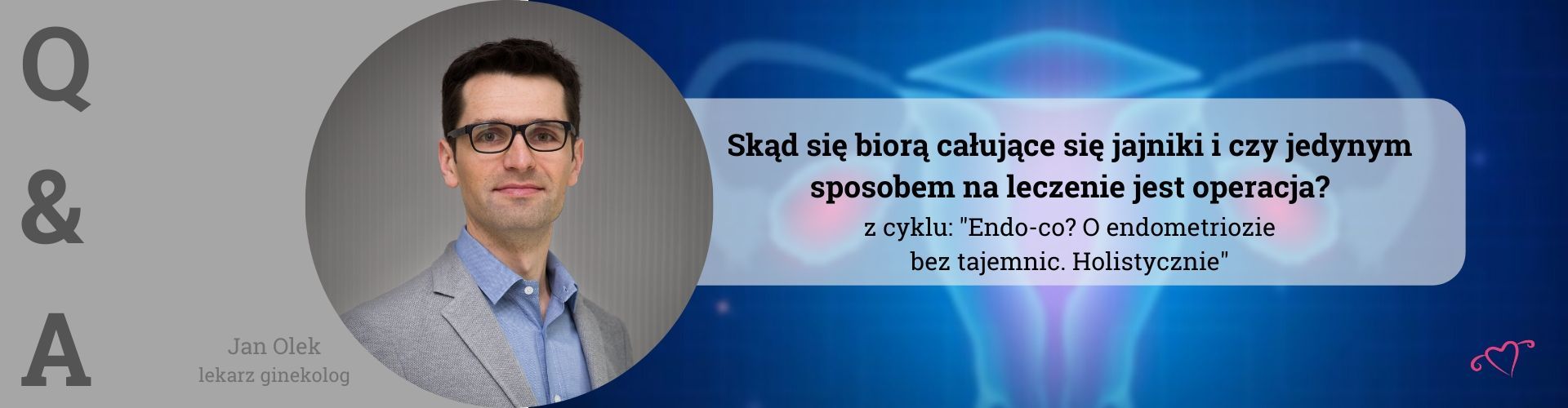 Skąd się biorą całujące się jajniki i czy jedynym sposobem na leczenie ...
